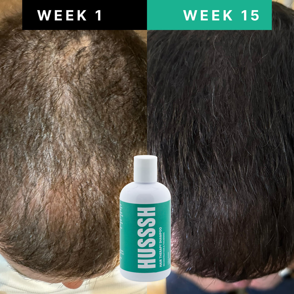Hair Recovery Shampoo for Thinning Hair – Hushhealth.co.uk